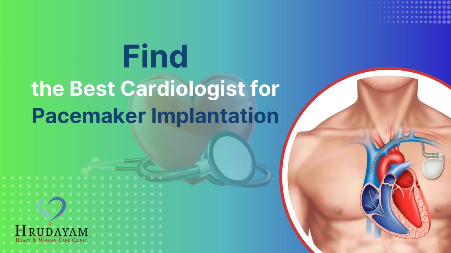 Find the Best Cardiologist for Pacemaker Implantation | Top Specialists ...
